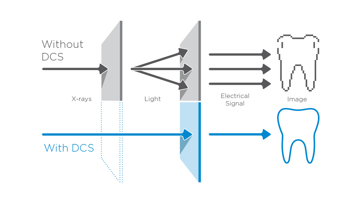 Orthophos SL 3D & 2D: X-Ray Machines | Dentsply Sirona India