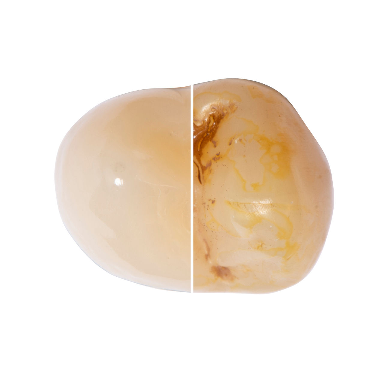 Neo Spectra™ ST Family | Dentsply Sirona India