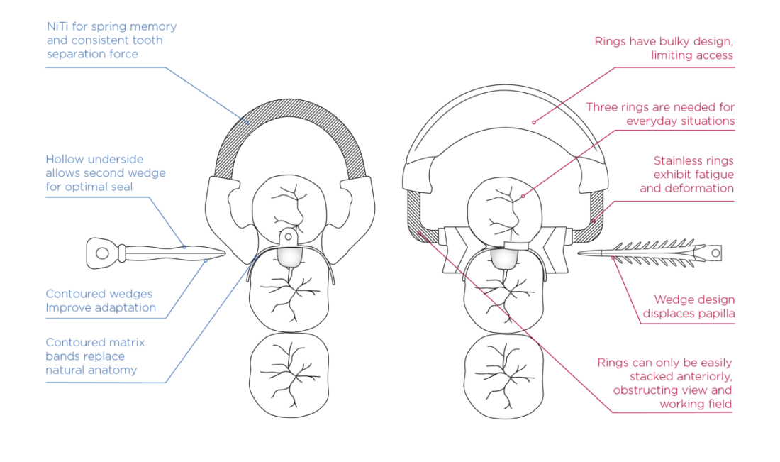 palodent matrix system sizes