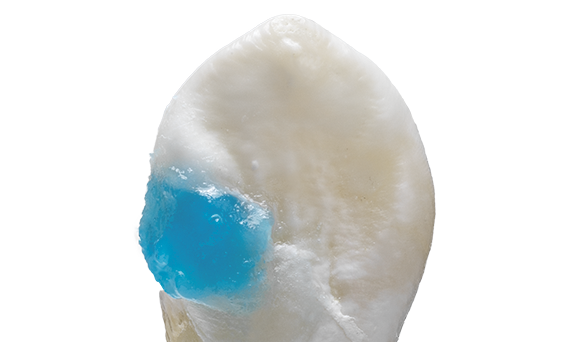 Prime&Bond Elect: Universal Dental Adhesive I Dentsply Sirona