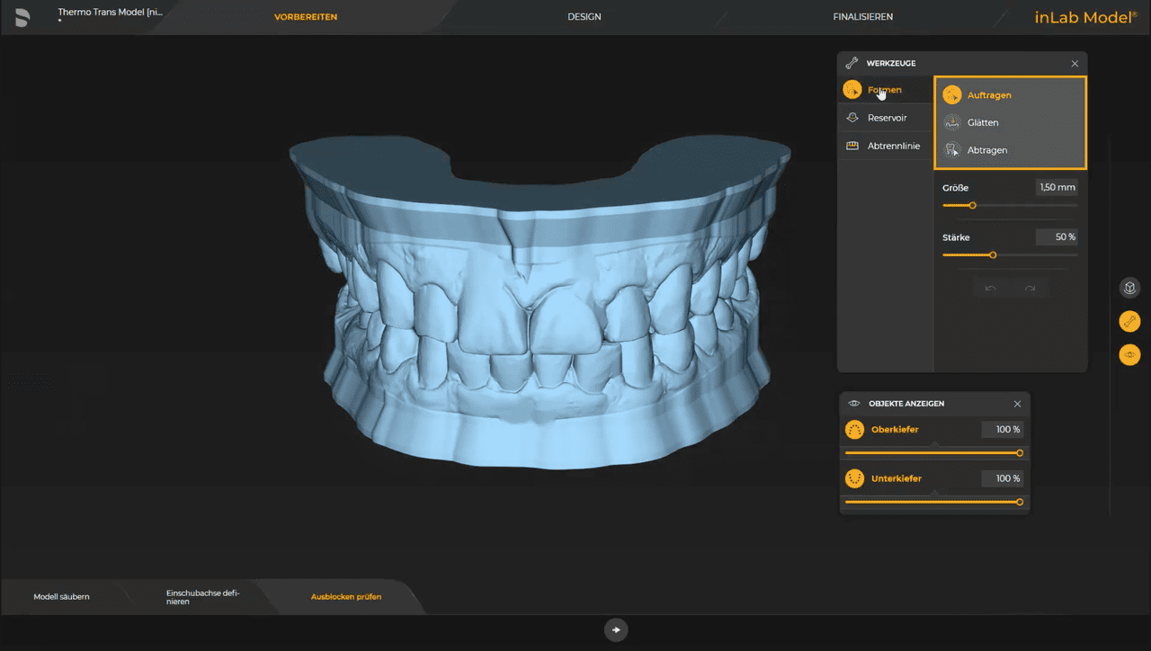 Primeprint Tutorials, Clinical Cases & More | Dentsply Sirona Northern ...