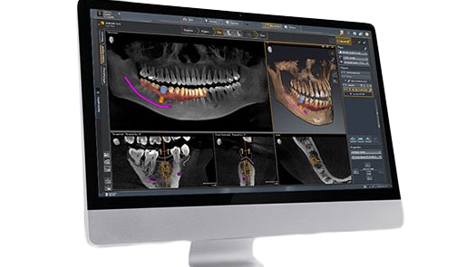 SICAT Dental Software | Dentsply Sirona