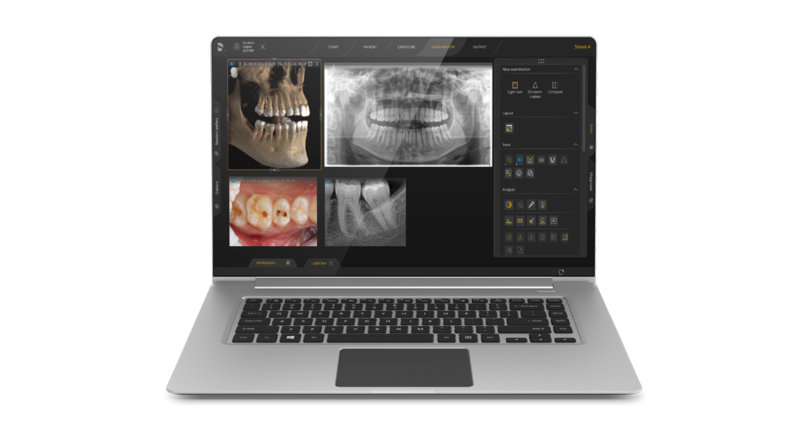 Sidexis 4: Dental Imaging Software | Dentsply Sirona