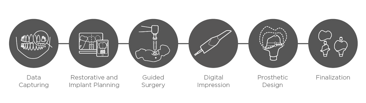 CEREC Implantology: Discover now! | Dentsply Sirona MK