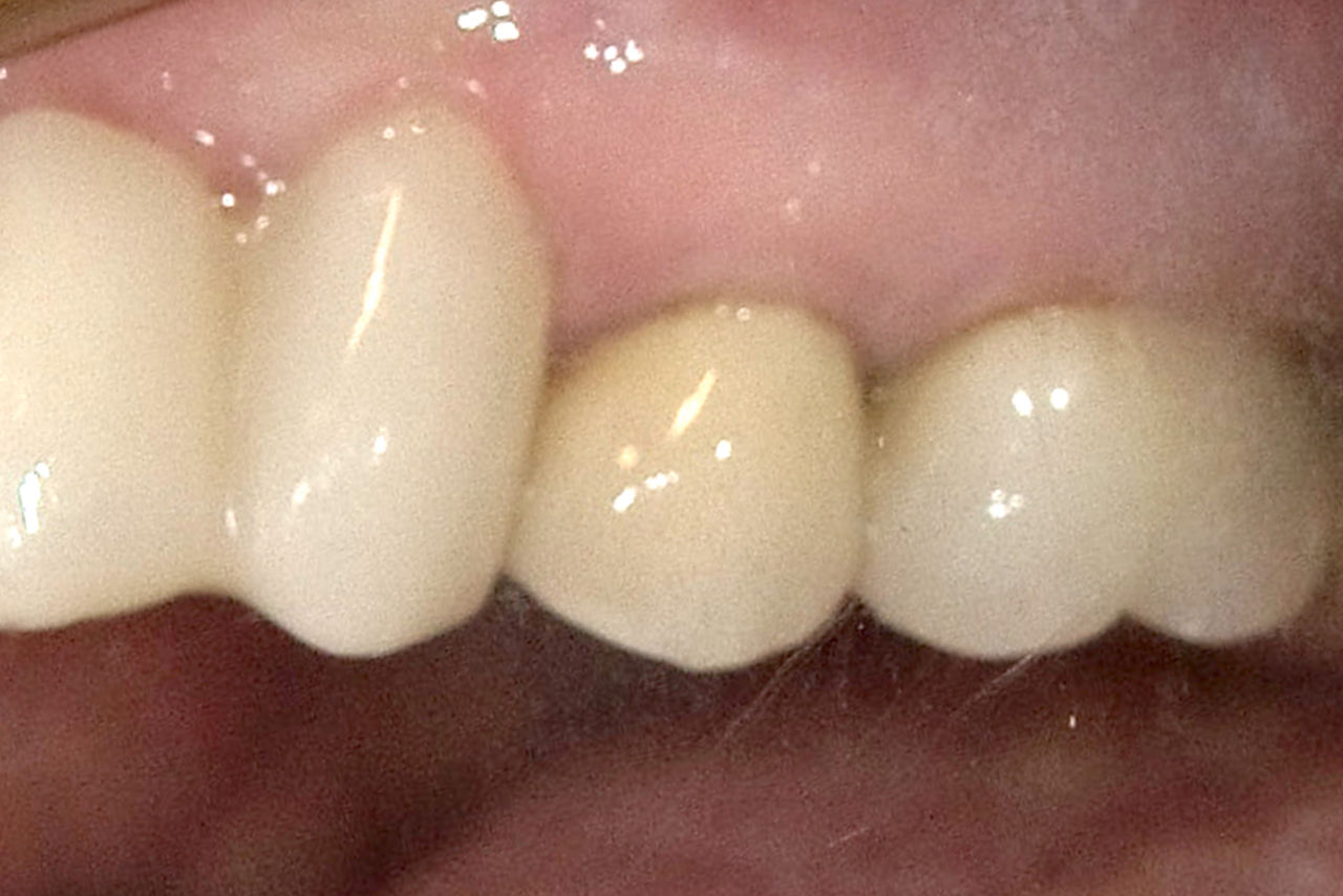 CEREC Case Studies | Dentsply Sirona North Macedonia