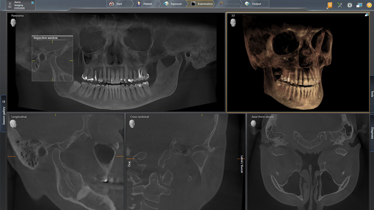 Axeos CBCT Machine | Dentsply Sirona Serbia