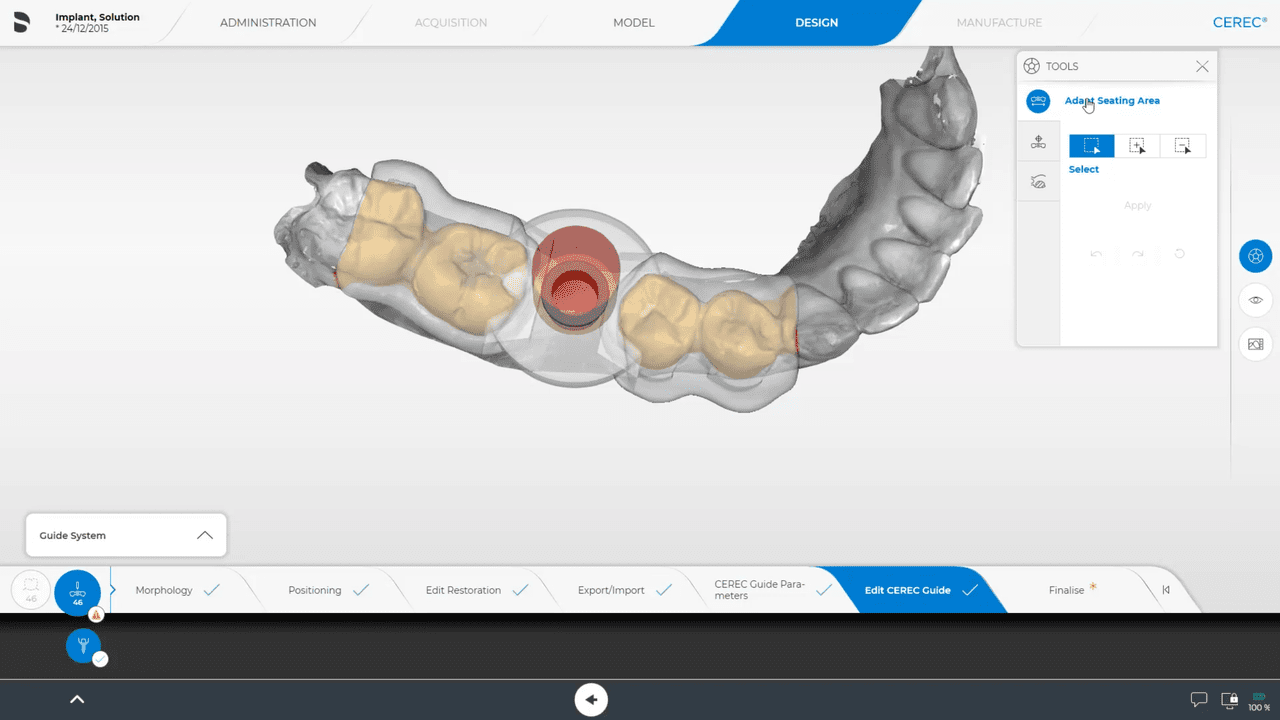 Primeprint Tutorials, Clinical Cases & More | Dentsply Sirona Serbia
