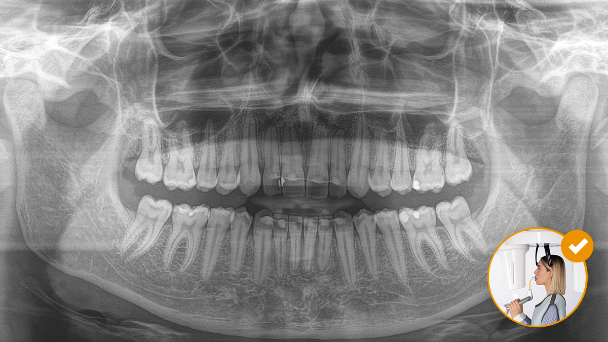 Exceptional X-ray Experience | Dentsply Sirona Serbia