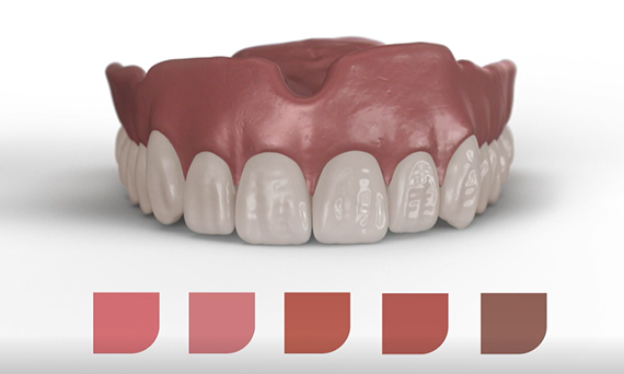 Your guide to 3d printed dentures / Dentsply Sirona Sweden
