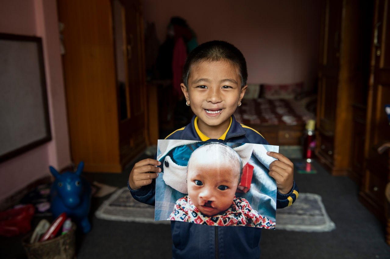 Smile Train: Learn more about our partnership | Dentsply Sirona