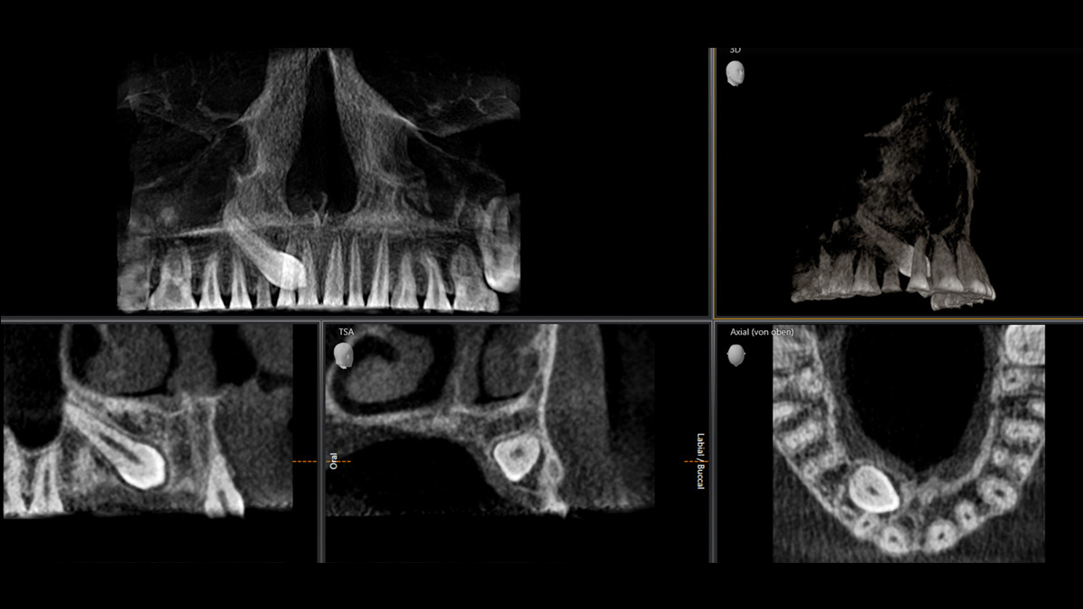 Orthophos S 2D/3D | Dentsply Sirona