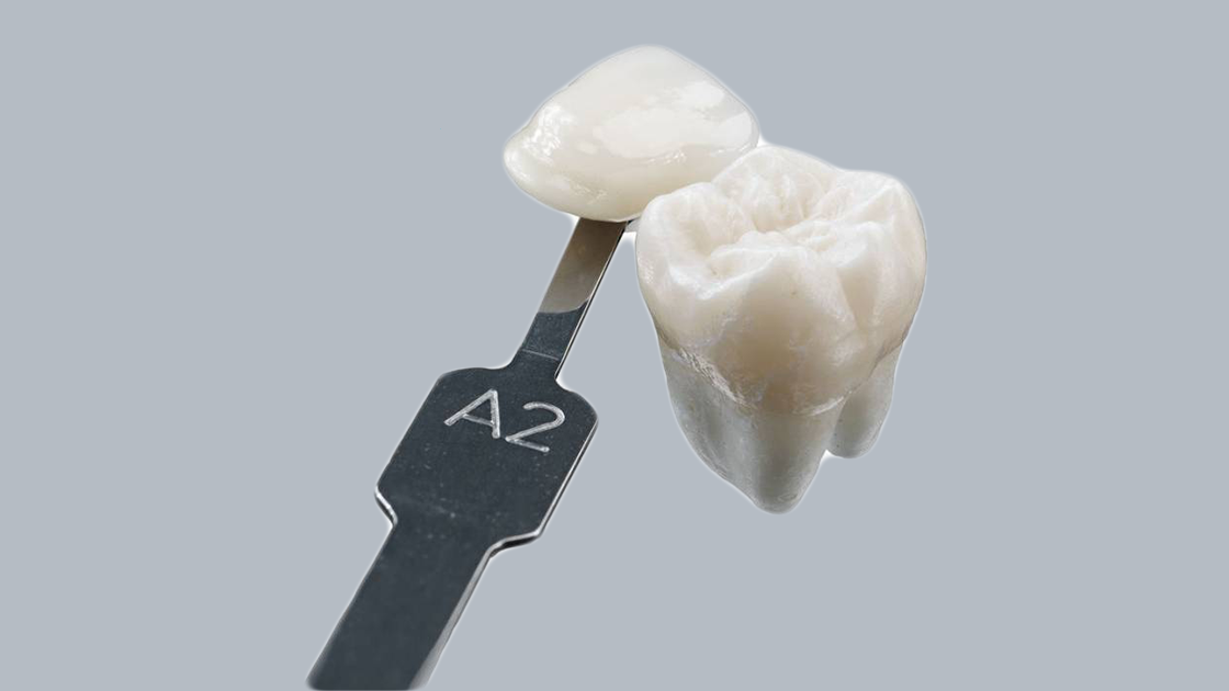 Guide to Class II Restoration Procedures | Dentsply Sirona