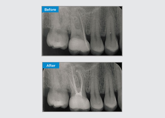 Clinical Case Spotlight: Discover now! | Dentsply Sirona USA