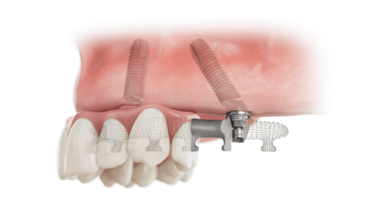 DS Academy Course Series | Dentsply Sirona USA