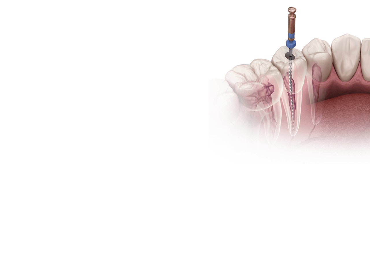 Indirect Restorative Course Series | Dentsply Sirona USA