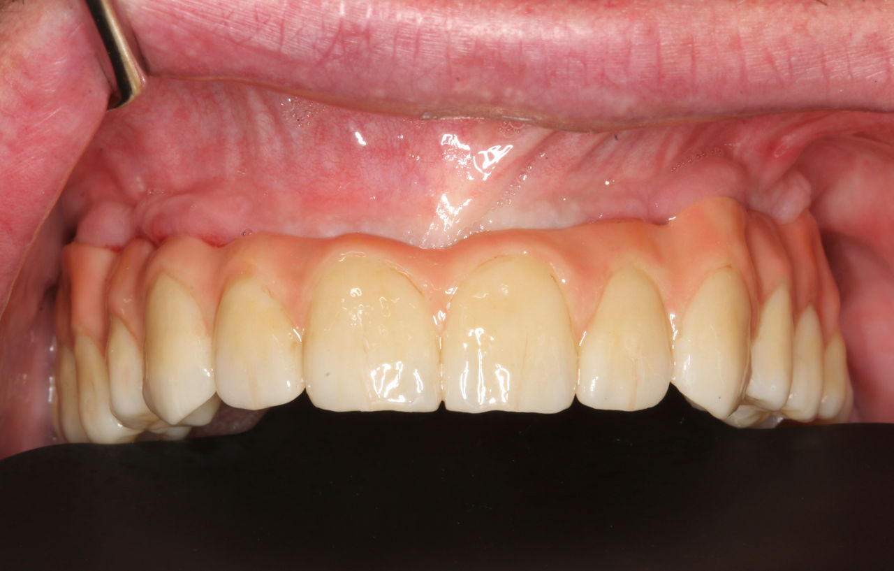 Atlantis Solutions Case Study Review | Dentsply Sirona USA