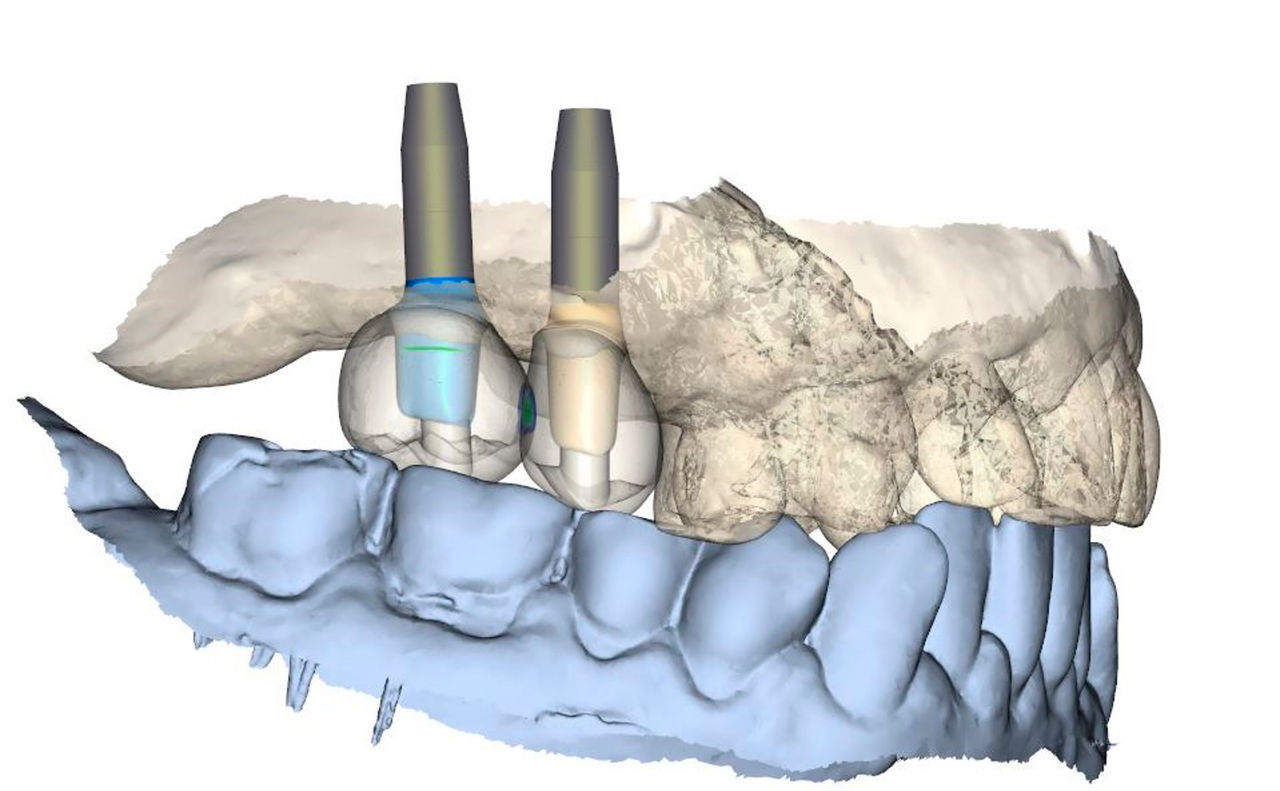 Atlantis Solutions Case Study Review | Dentsply Sirona USA