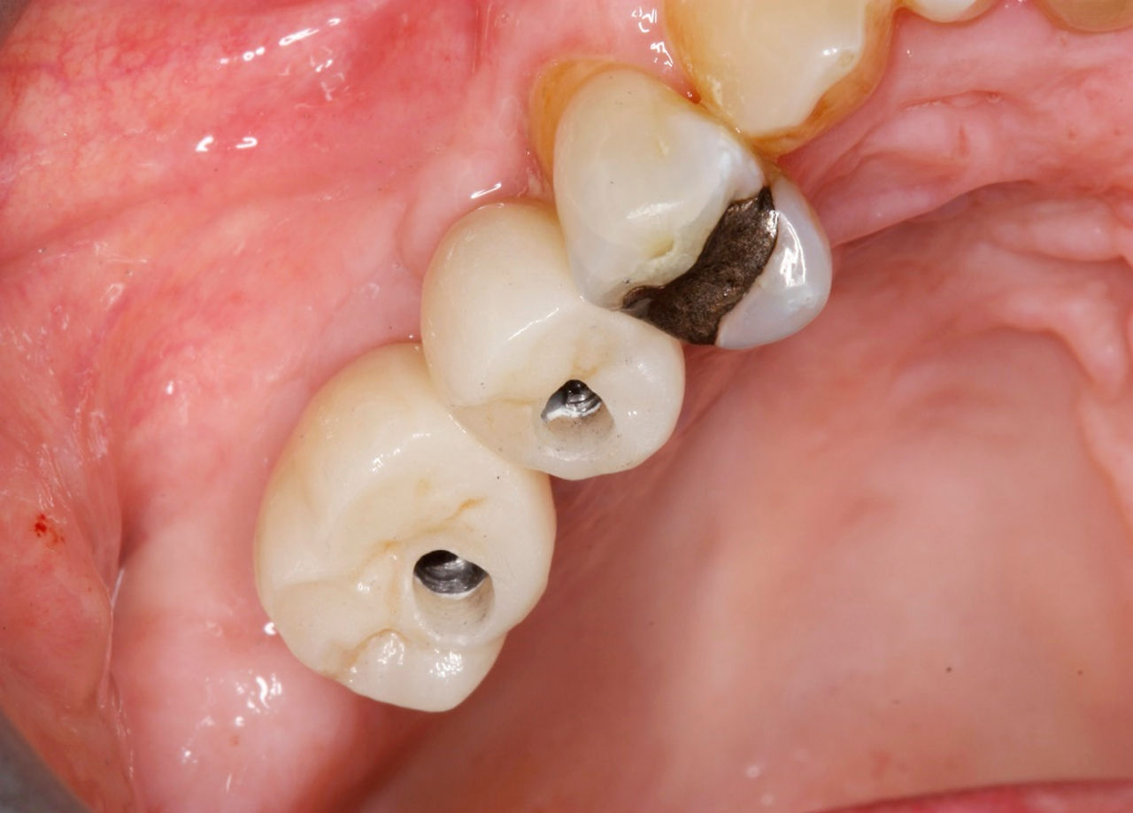 Atlantis Solutions Case Study Review | Dentsply Sirona USA