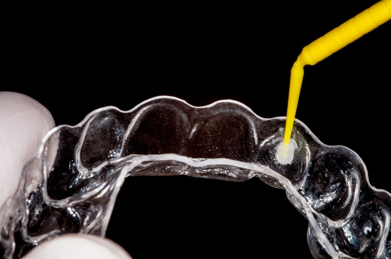 SureSmile Attachment Bonding with TPH Spectra® ST | Dentsply Sirona USA