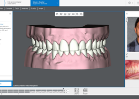 Innovation | Dentsply Sirona