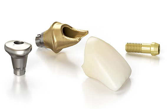 Atlantis Dental Abutments | Dentsply Sirona USA