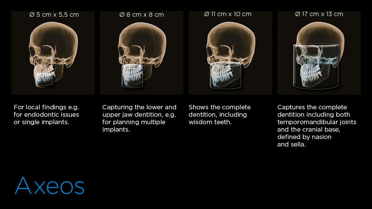 Axeos CBCT Machine | Dentsply Sirona