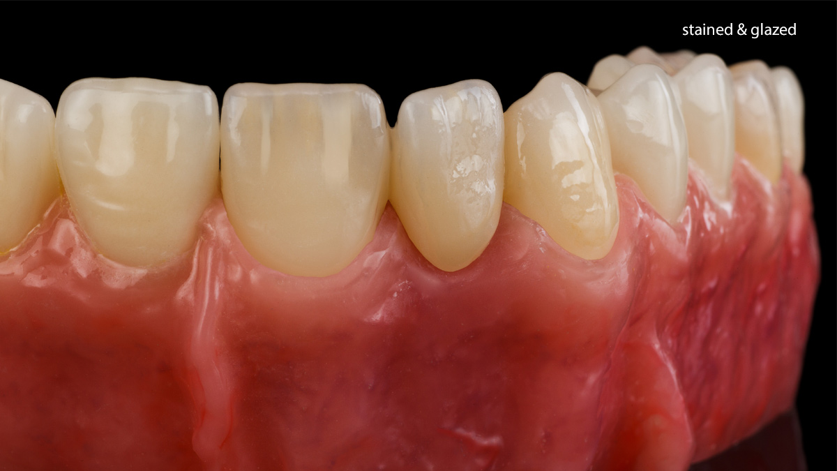 Cercon xt ML | Dentsply Sirona