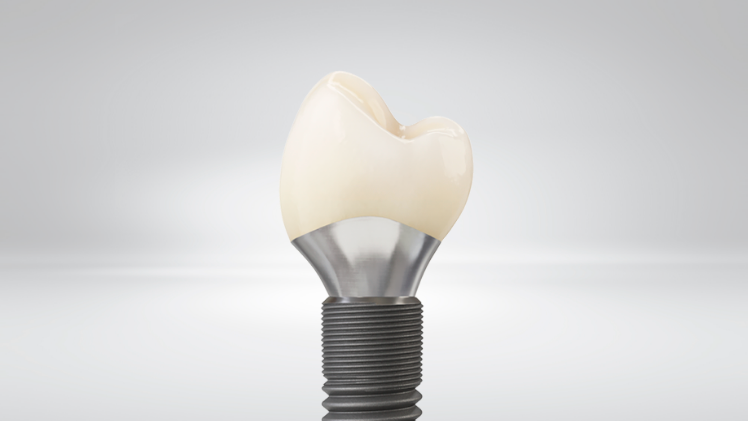 DS Primetaper | Dentsply Sirona USA