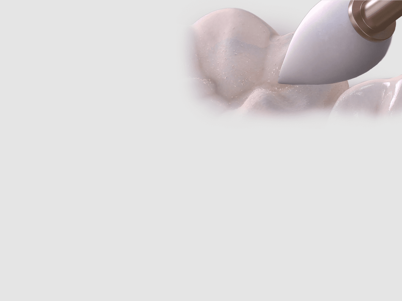 Enhance Finishing System | Dentsply Sirona USA