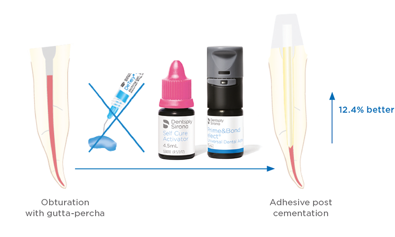FluoroCore 2+ Core Build Up I Dentsply Sirona