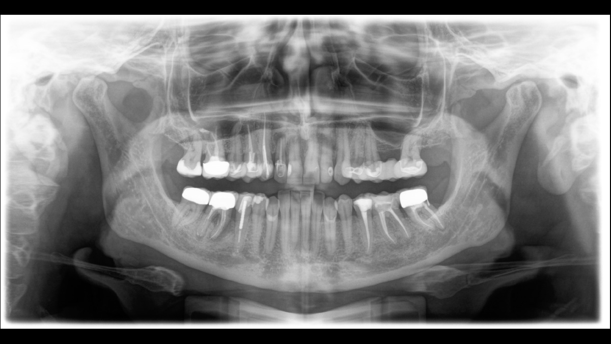 Orthophos S 2D/3D | Dentsply Sirona USA
