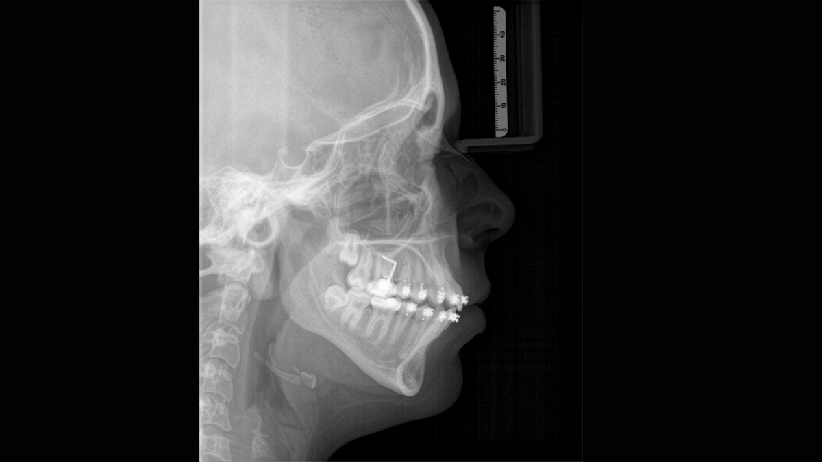 Orthophos S 2D/3D | Dentsply Sirona USA