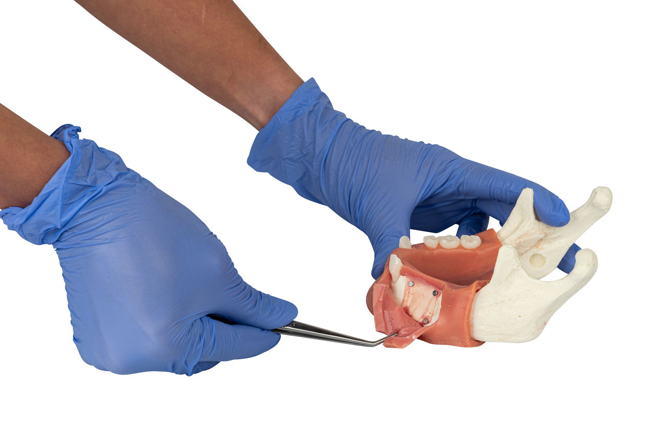 OSSIX Agile: Discover now! | Dentsply Sirona USA