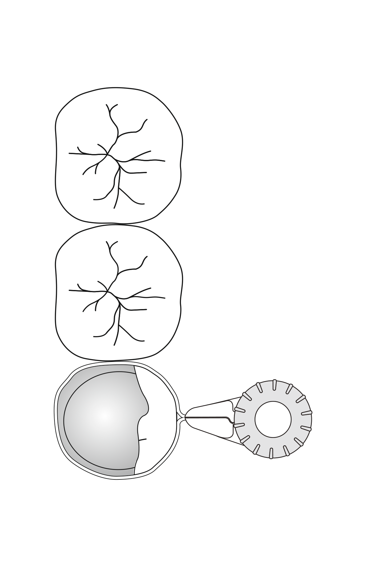 Palodent Matrix Systems | Denstply Sirona USA