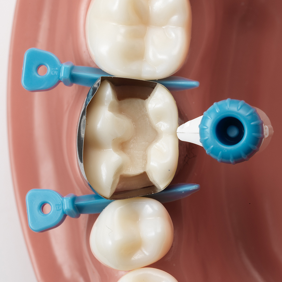Palodent 360: Circumferential Matrix System | Dentsply Sirona
