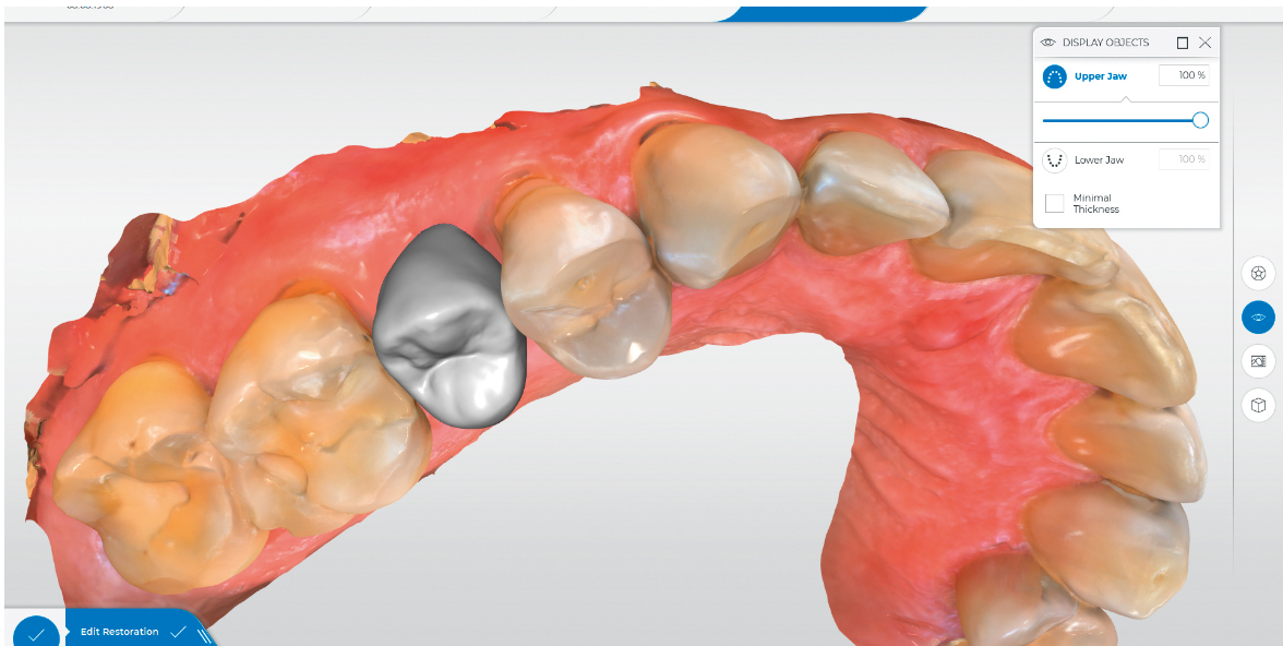 Primeprint Digital Workflows | Dentsply Sirona USA