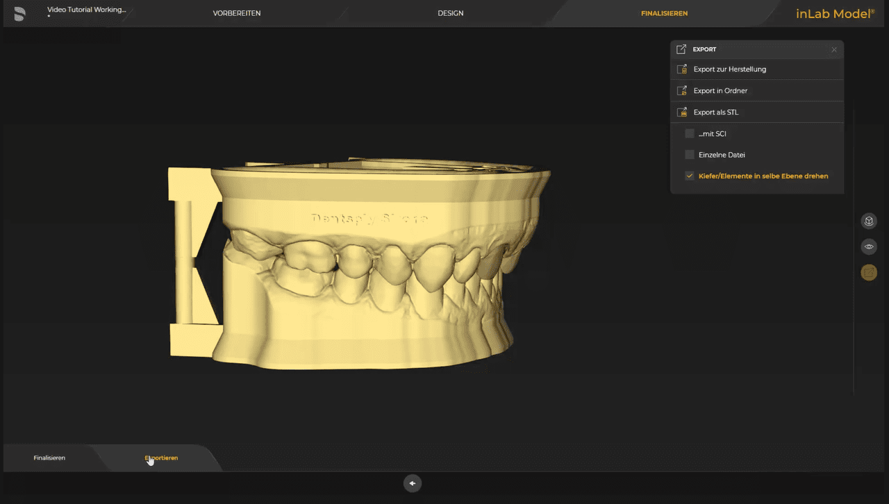 Primeprint Tutorials, Clinical Cases & More | Dentsply Sirona USA