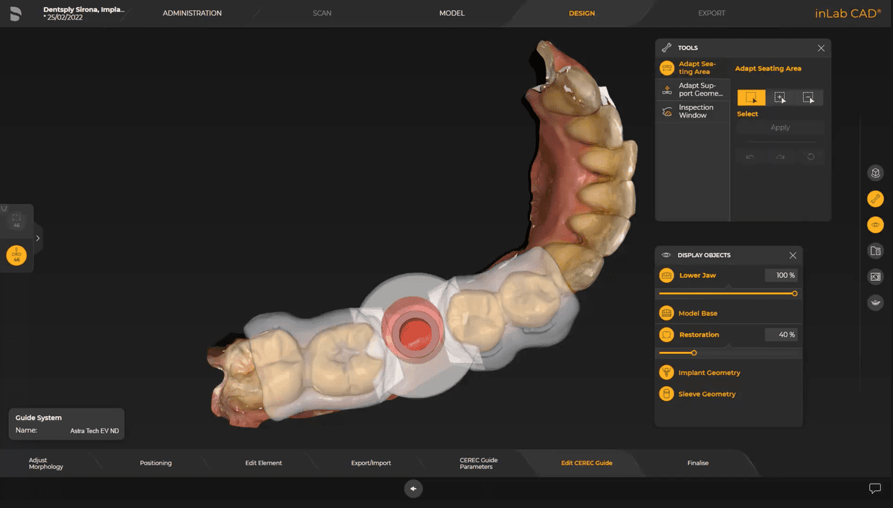 Primeprint Tutorials, Clinical Cases & More | Dentsply Sirona