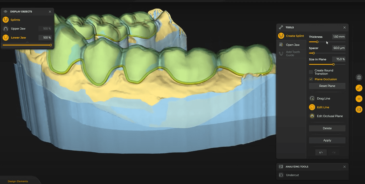 Primeprint Tutorials, Clinical Cases & More | Dentsply Sirona USA