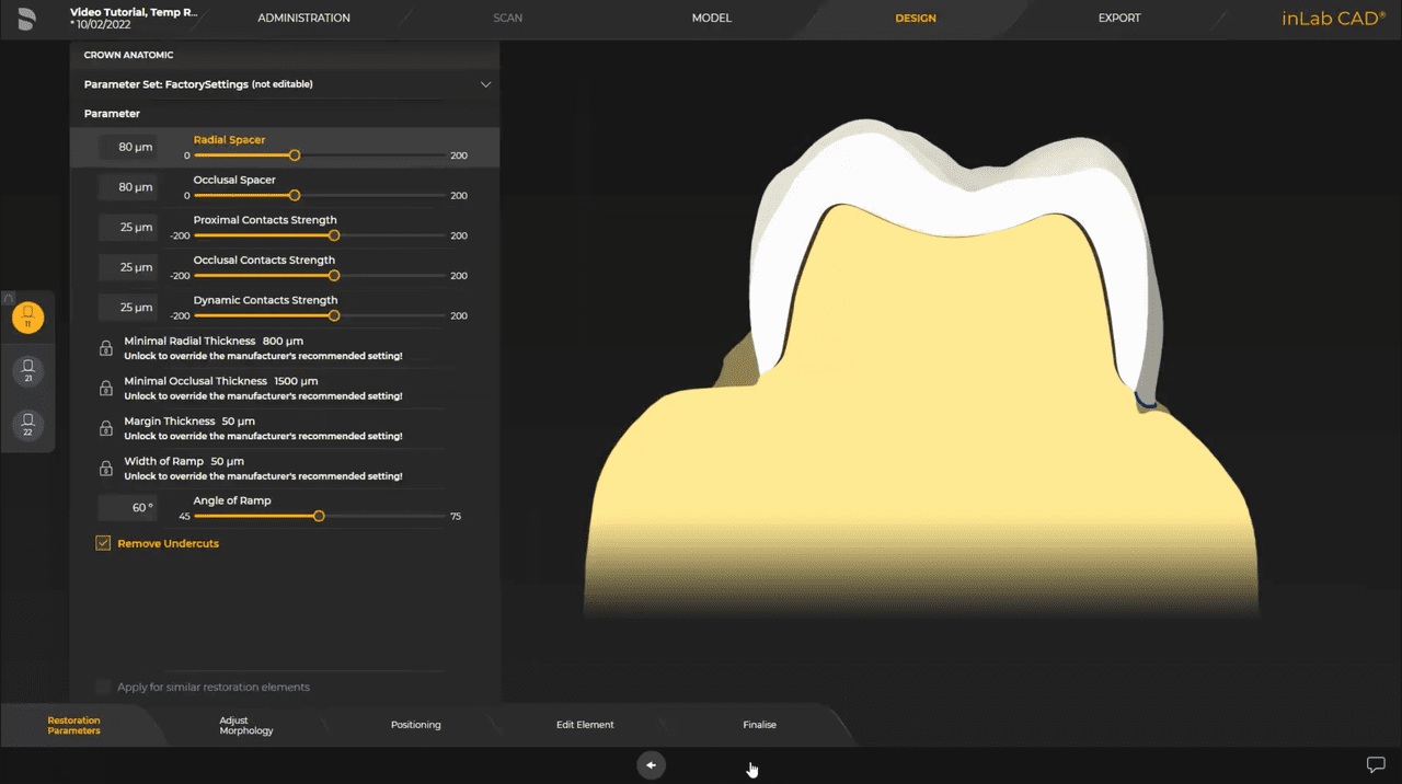 Primeprint Tutorials, Clinical Cases & More | Dentsply Sirona USA