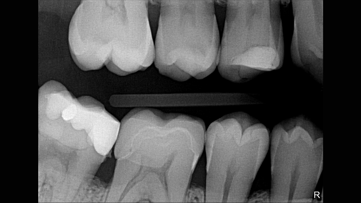 Schick 33 Sensors | Dentsply Sirona USA
