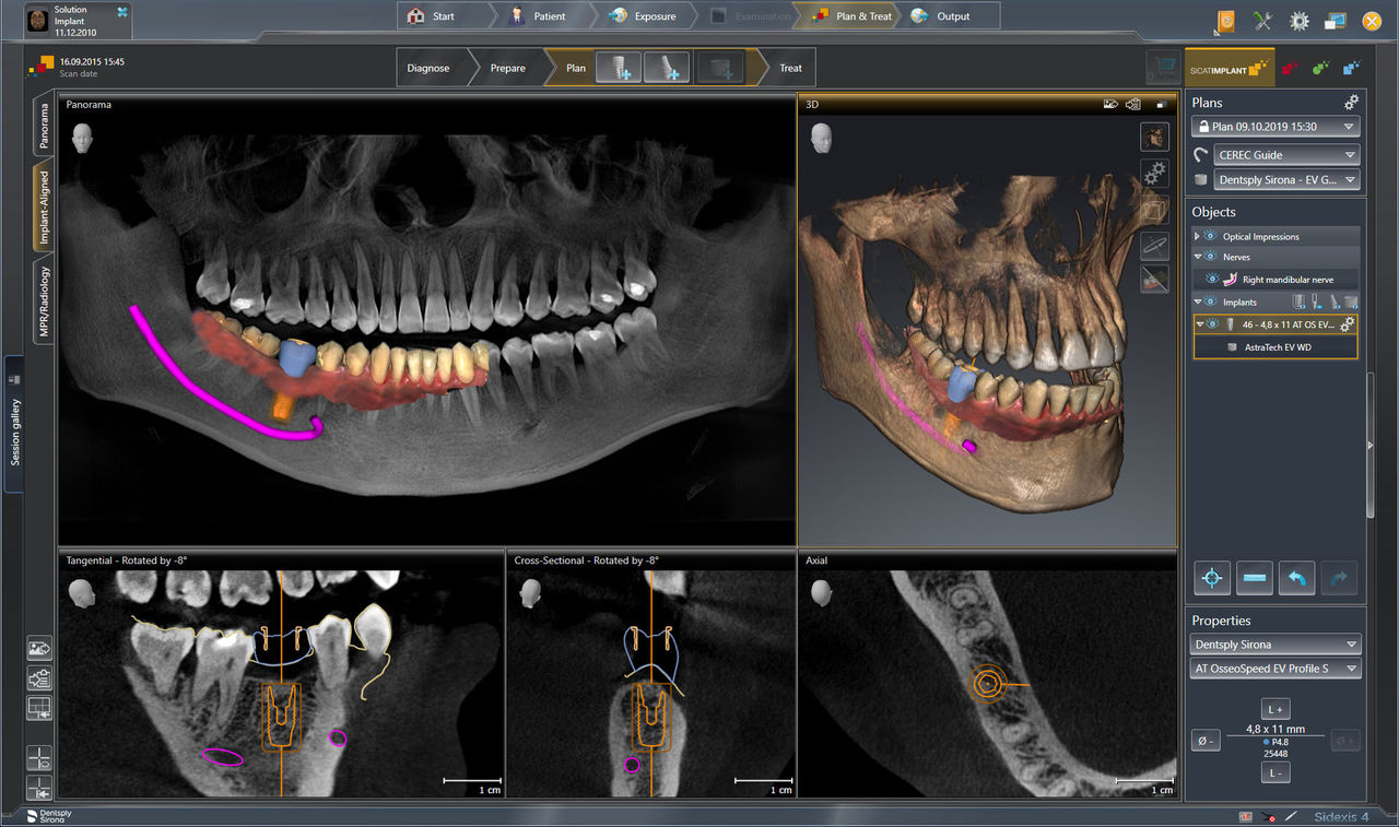 SICAT Dental Software | Dentsply Sirona