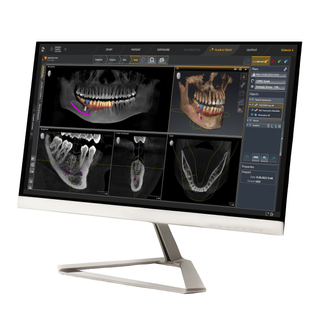 SICAT Dental Software | Dentsply Sirona