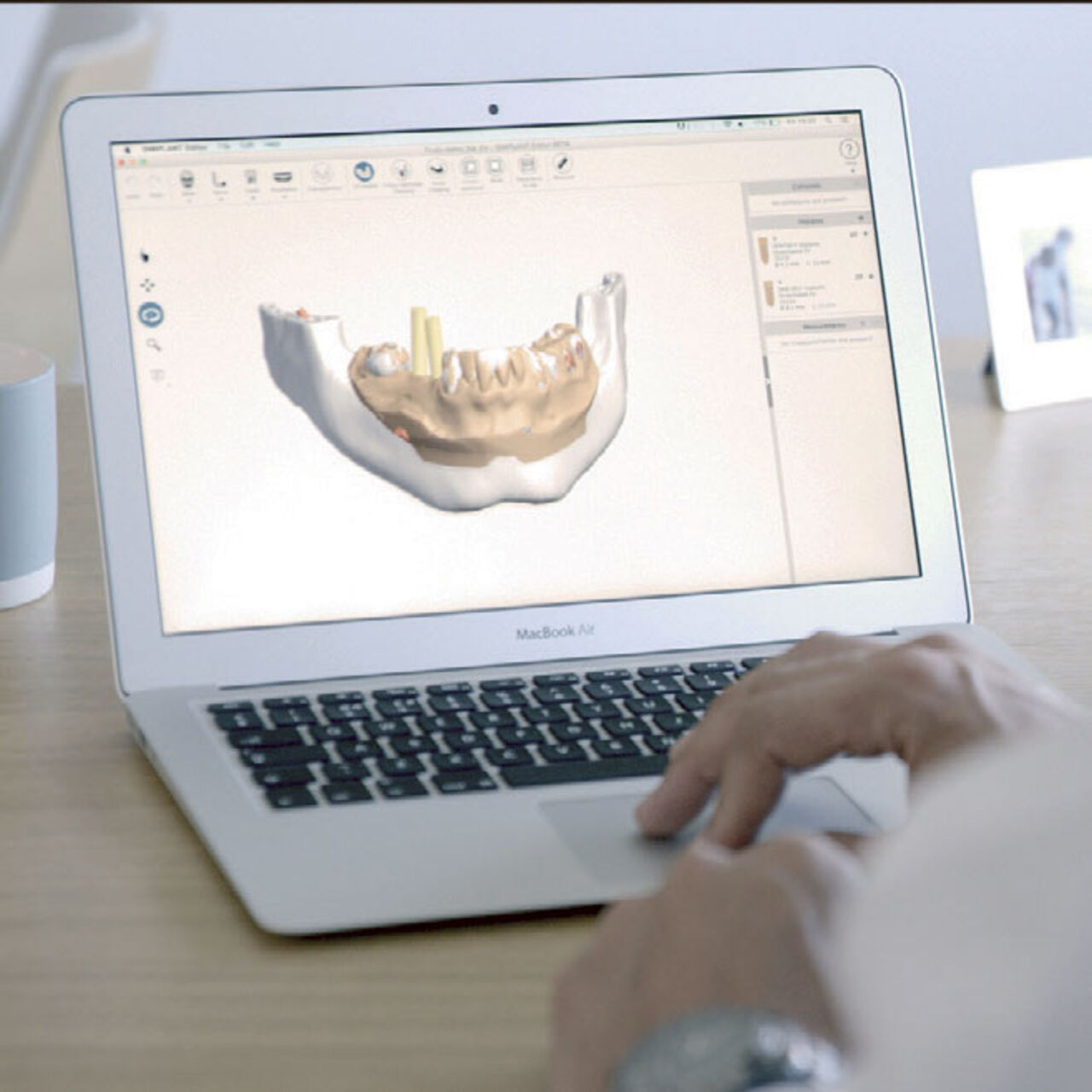 Simplant Implant Planning Software | Dentsply Sirona USA