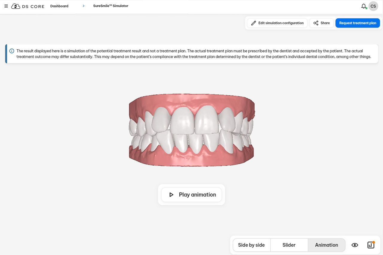 SureSmile Simulator | Dentsply Sirona USA