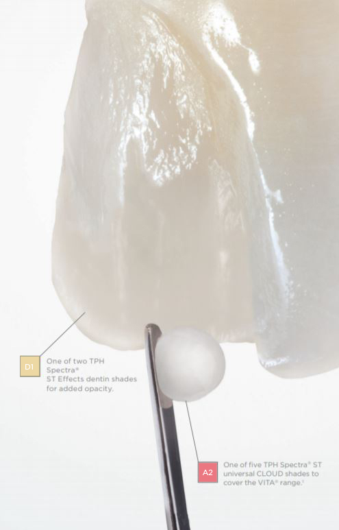 TPH Spectra ST Effects | Dentsply Sirona USA