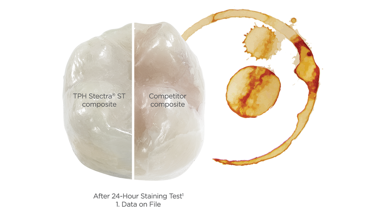 TPH Spectra ST | Dentsply Sirona