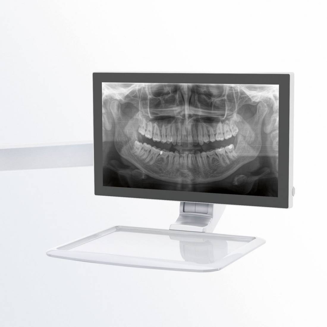 Cmos Dental Digital Radiography