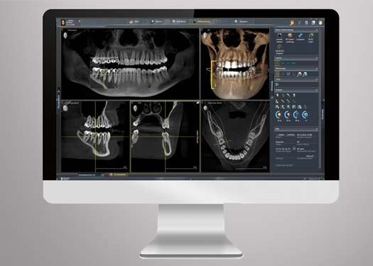 digital x ray processing dental