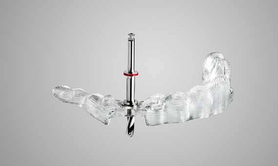 CEREC Implantology: Discover now! | Dentsply Sirona